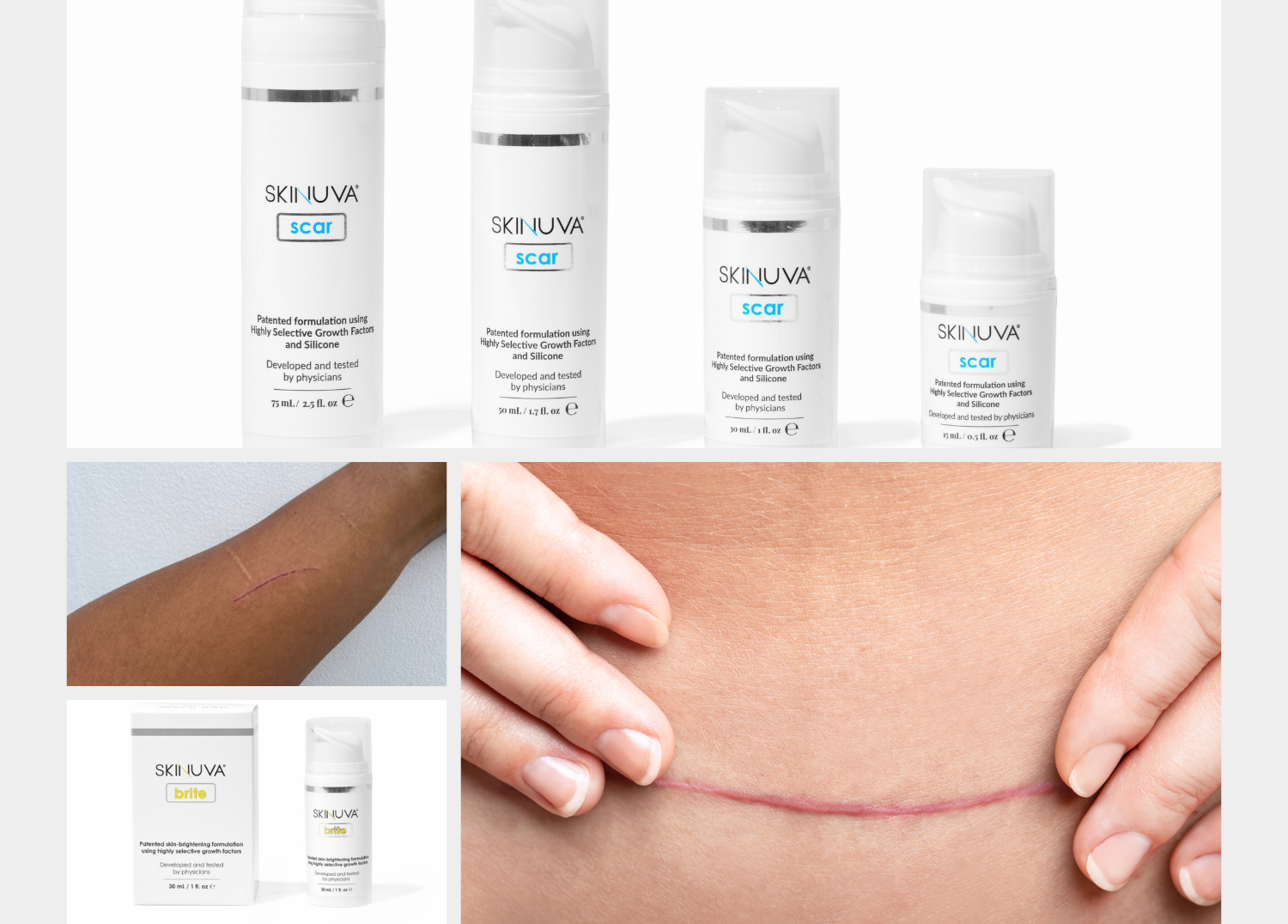 Addressing Scar Discoloration Before Patients Ask: Elevating Post-Proc ...