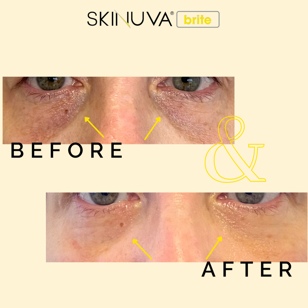 Advanced, Science-Backed Skincare | Shop the Skinuva® Collection