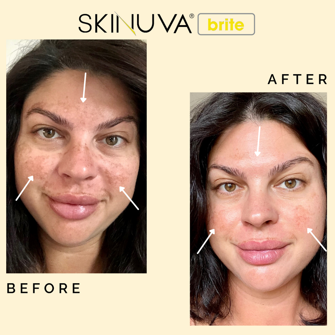 Advanced, Science-Backed Skincare | Shop the Skinuva® Collection